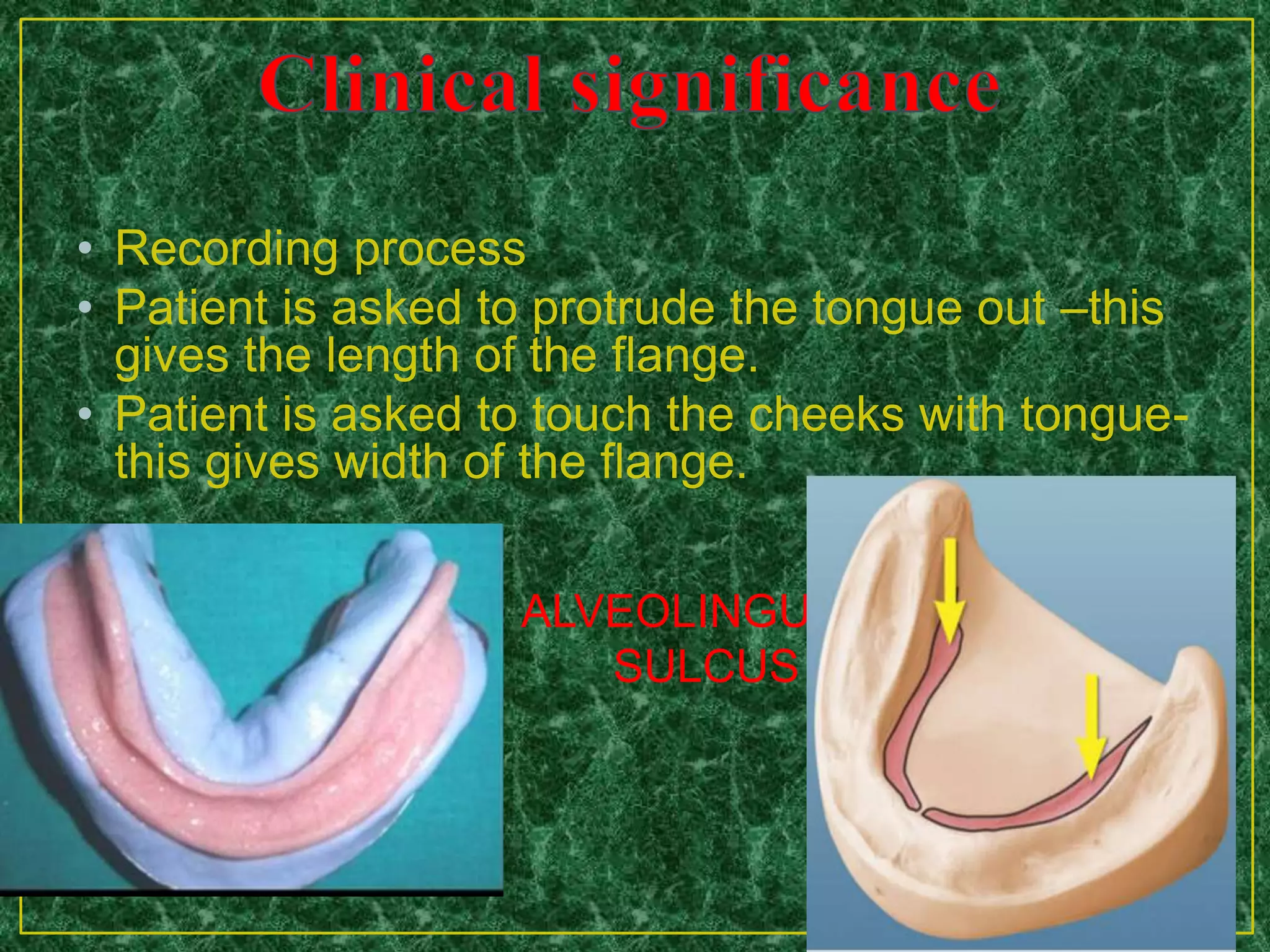 Anatomical Landmarks Mandibular prosthodontics | PPTX