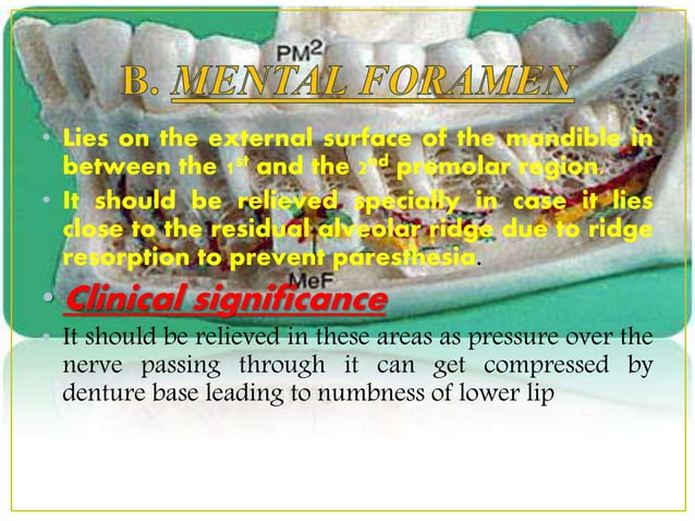 Anatomical Landmarks Mandibular prosthodontics | PPTX