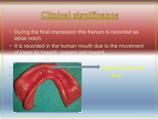 Anatomical Landmarks Mandibular prosthodontics | PPTX