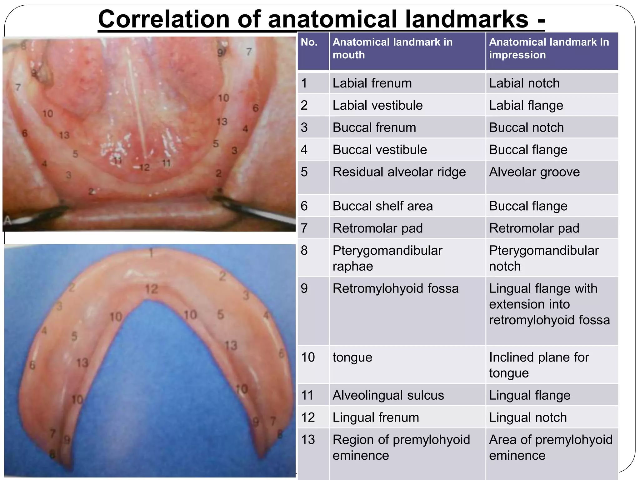 MANDIBULAR ANATOMICAL LANDMARK APOORWA - Copy - Copy.pptx