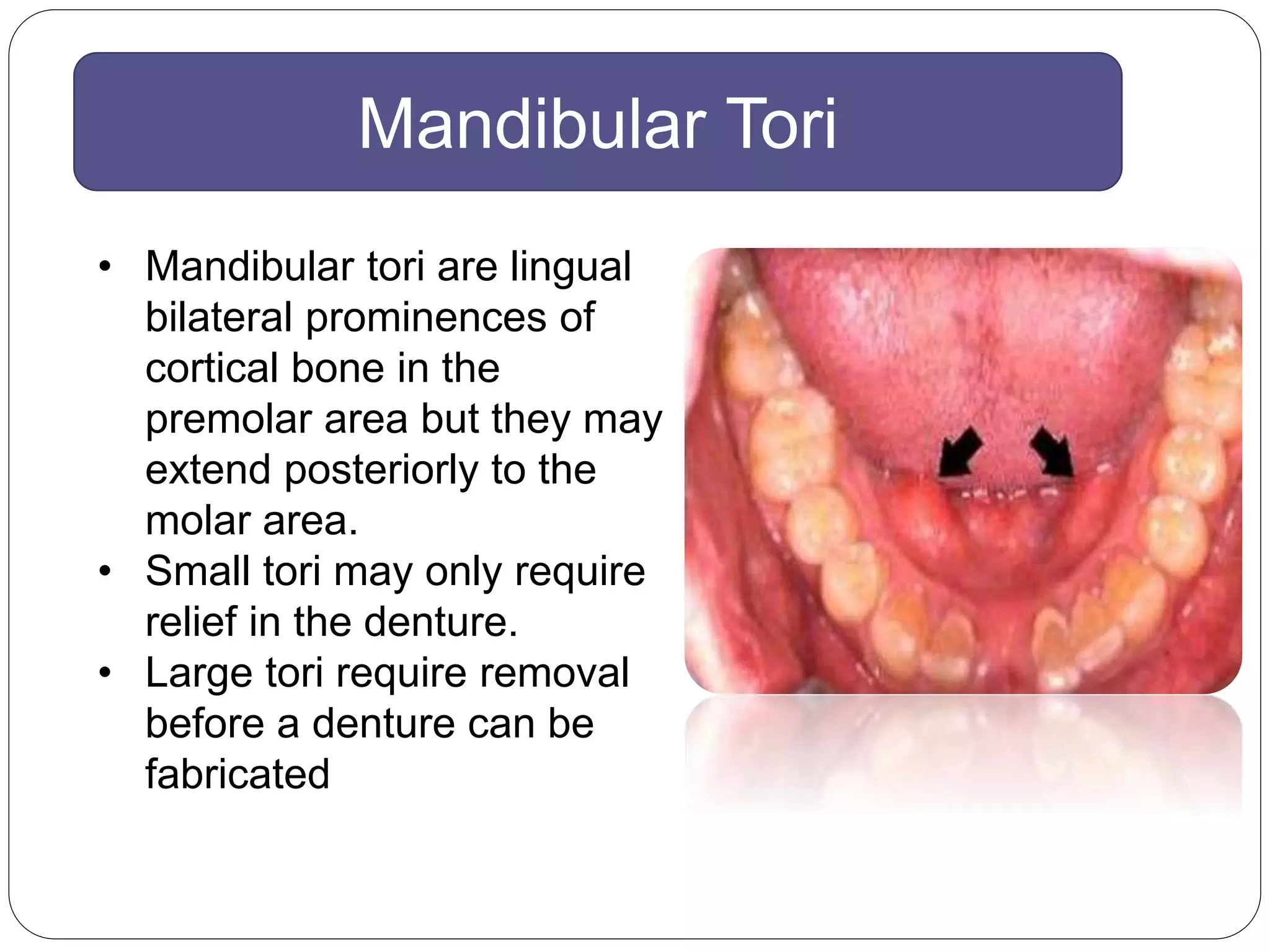 MANDIBULAR ANATOMICAL LANDMARK APOORWA - Copy - Copy.pptx