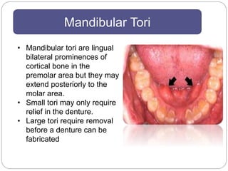 MANDIBULAR ANATOMICAL LANDMARK APOORWA - Copy - Copy.pptx