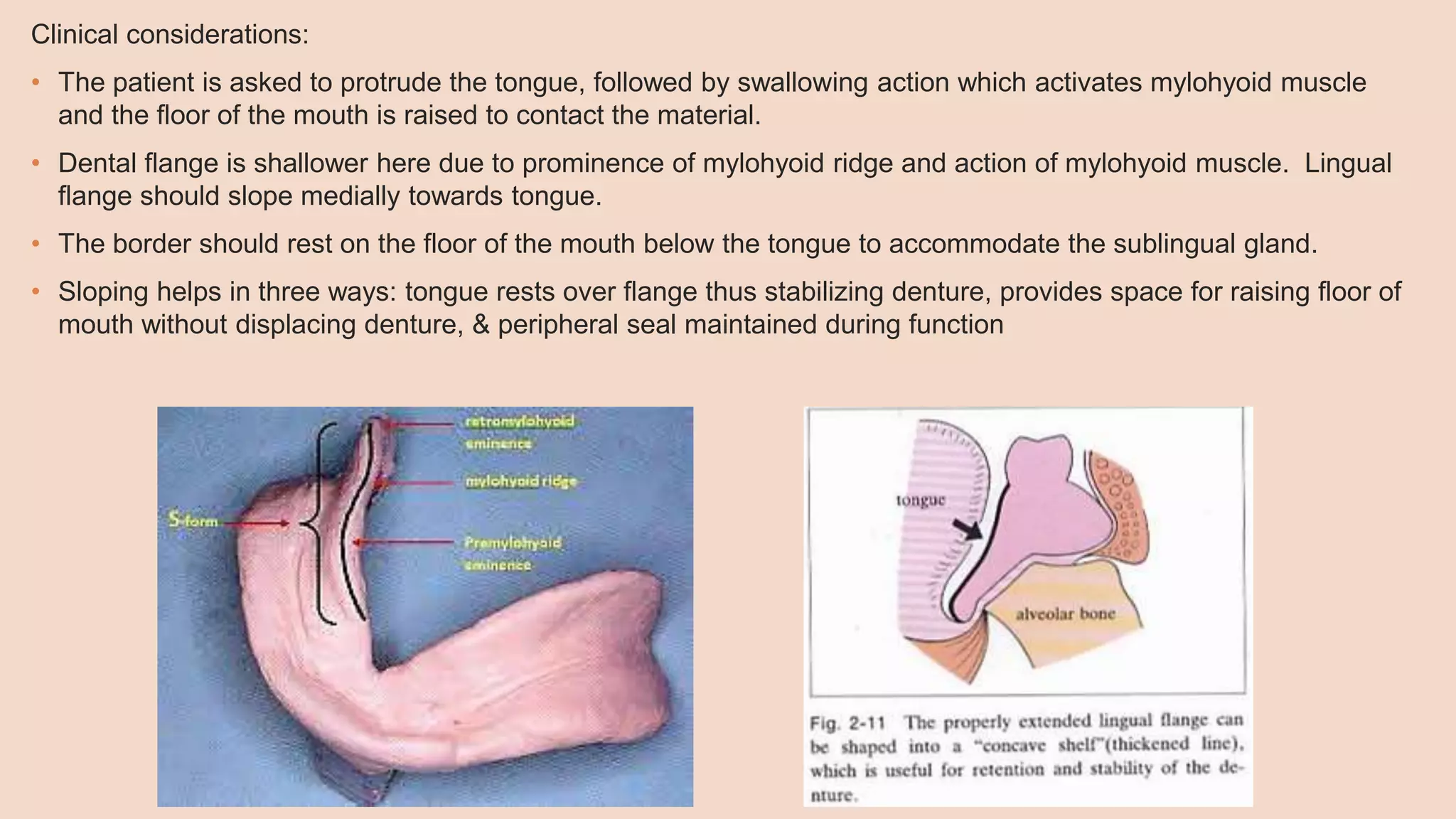 Mandibular anatomical landmarks | PPTX | Dental Health | Diseases and ...