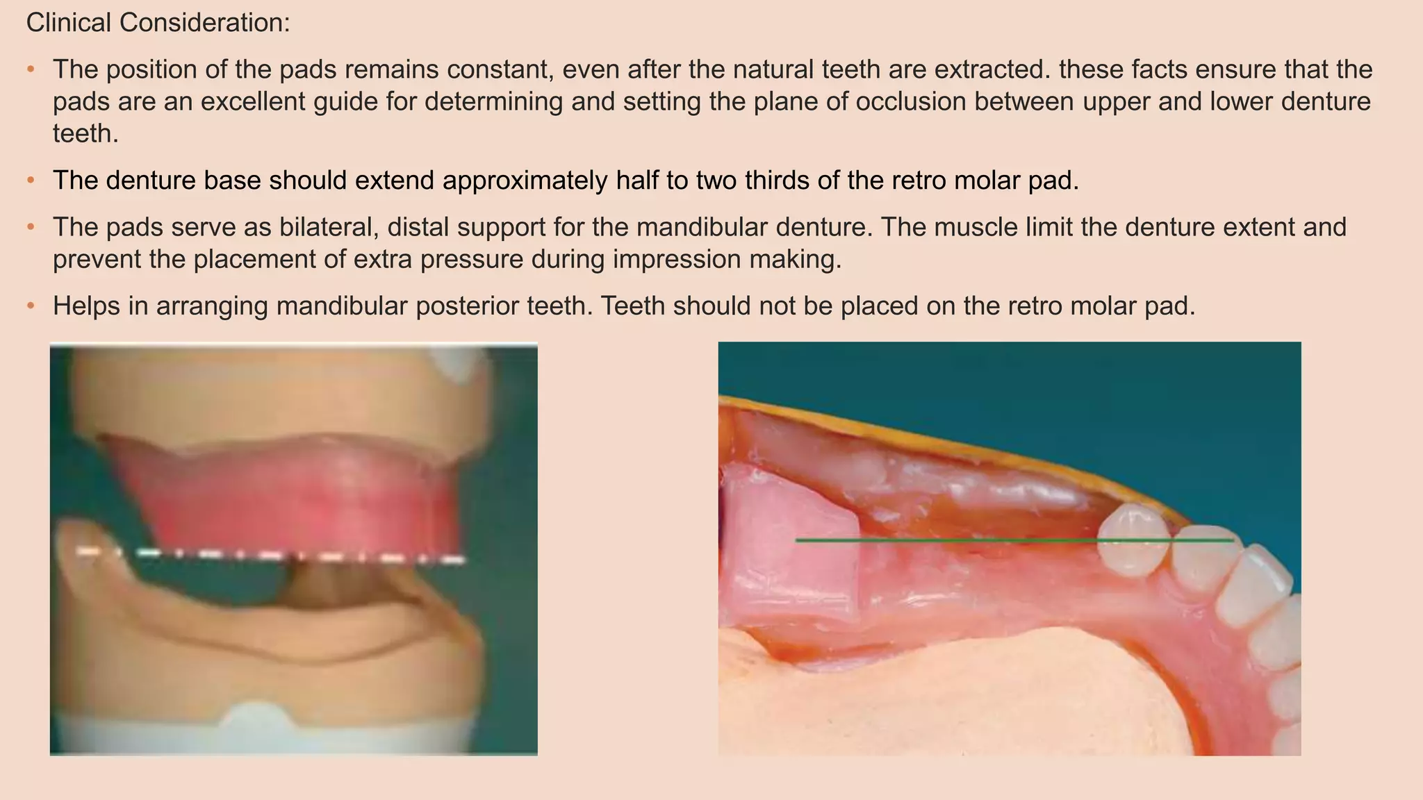 Mandibular anatomical landmarks | PPTX | Dental Health | Diseases and ...