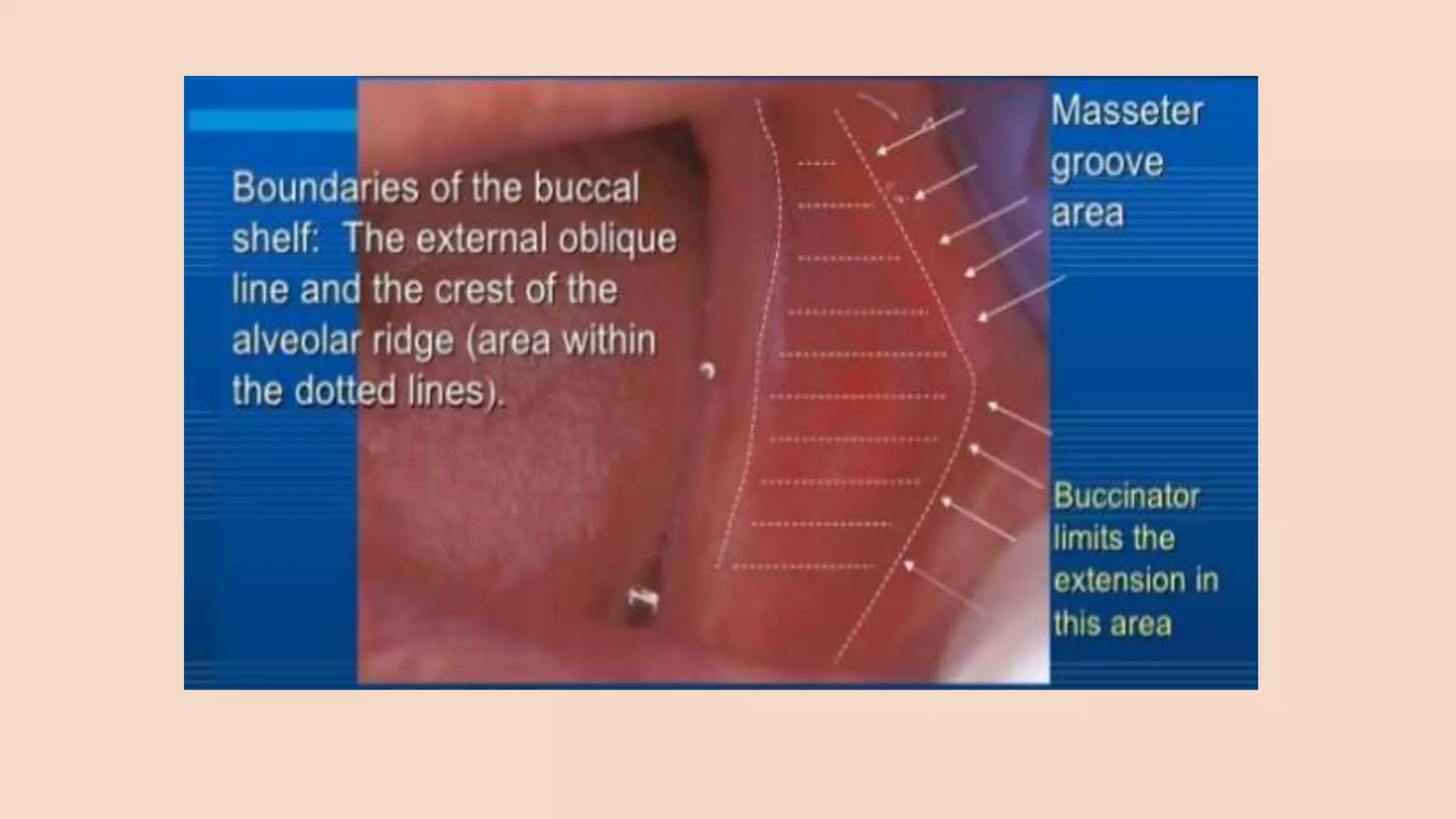 Mandibular anatomical landmarks | PPTX | Dental Health | Diseases and ...