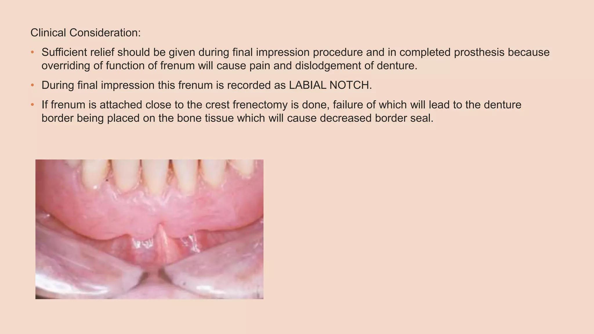 Mandibular anatomical landmarks | PPTX