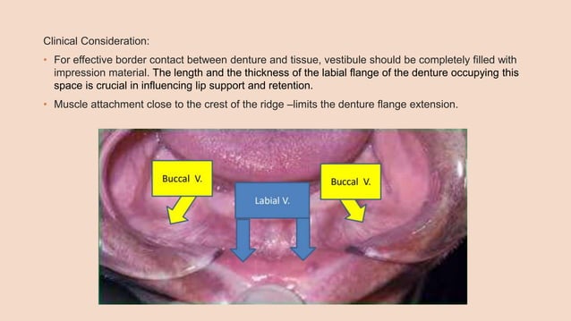 Mandibular anatomical landmarks | PPTX | Dental Health | Diseases and ...