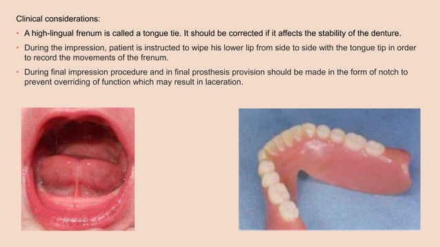 Mandibular anatomical landmarks | PPTX | Dental Health | Diseases and ...