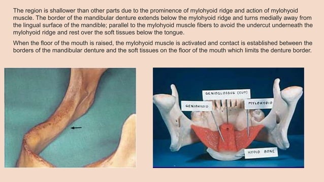 Mandibular anatomical landmarks | PPTX | Dental Health | Diseases and ...