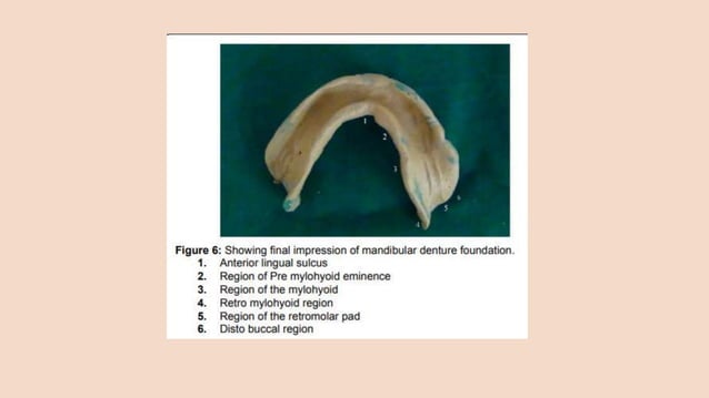 Mandibular anatomical landmarks | PPTX | Dental Health | Diseases and ...