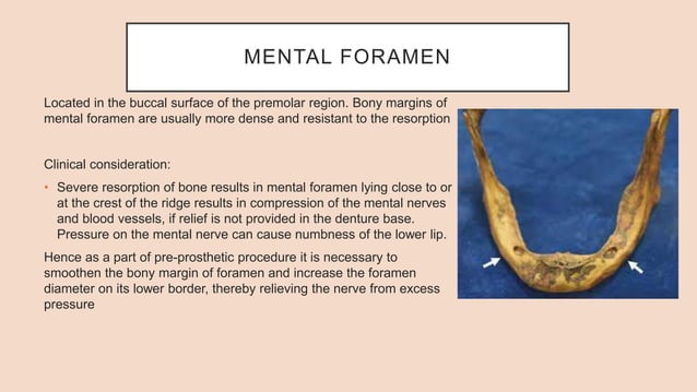 Mandibular anatomical landmarks | PPTX | Dental Health | Diseases and ...