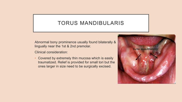 Mandibular anatomical landmarks | PPTX | Dental Health | Diseases and ...
