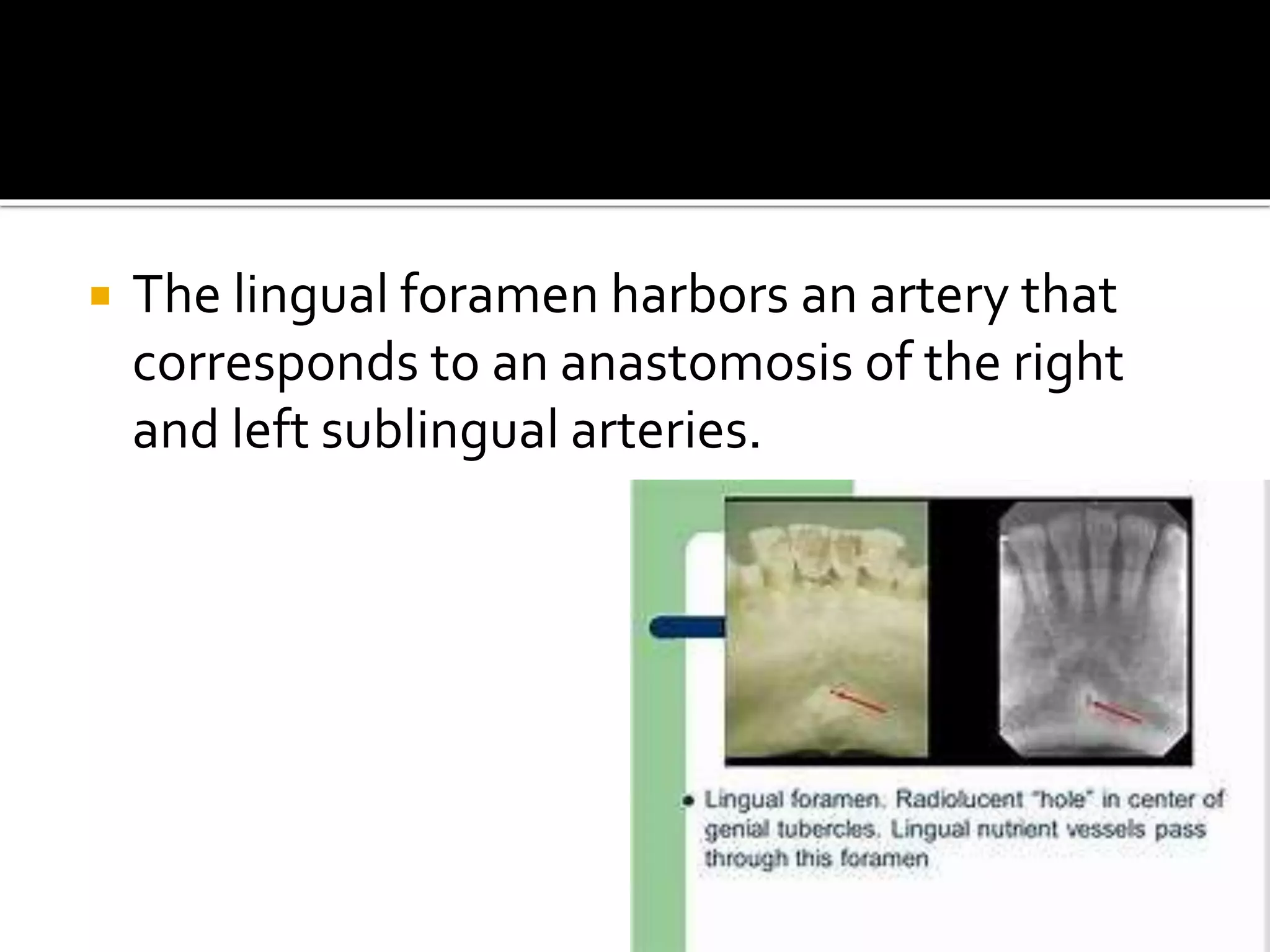 Mandibular anatomy for dental implant | PPTX