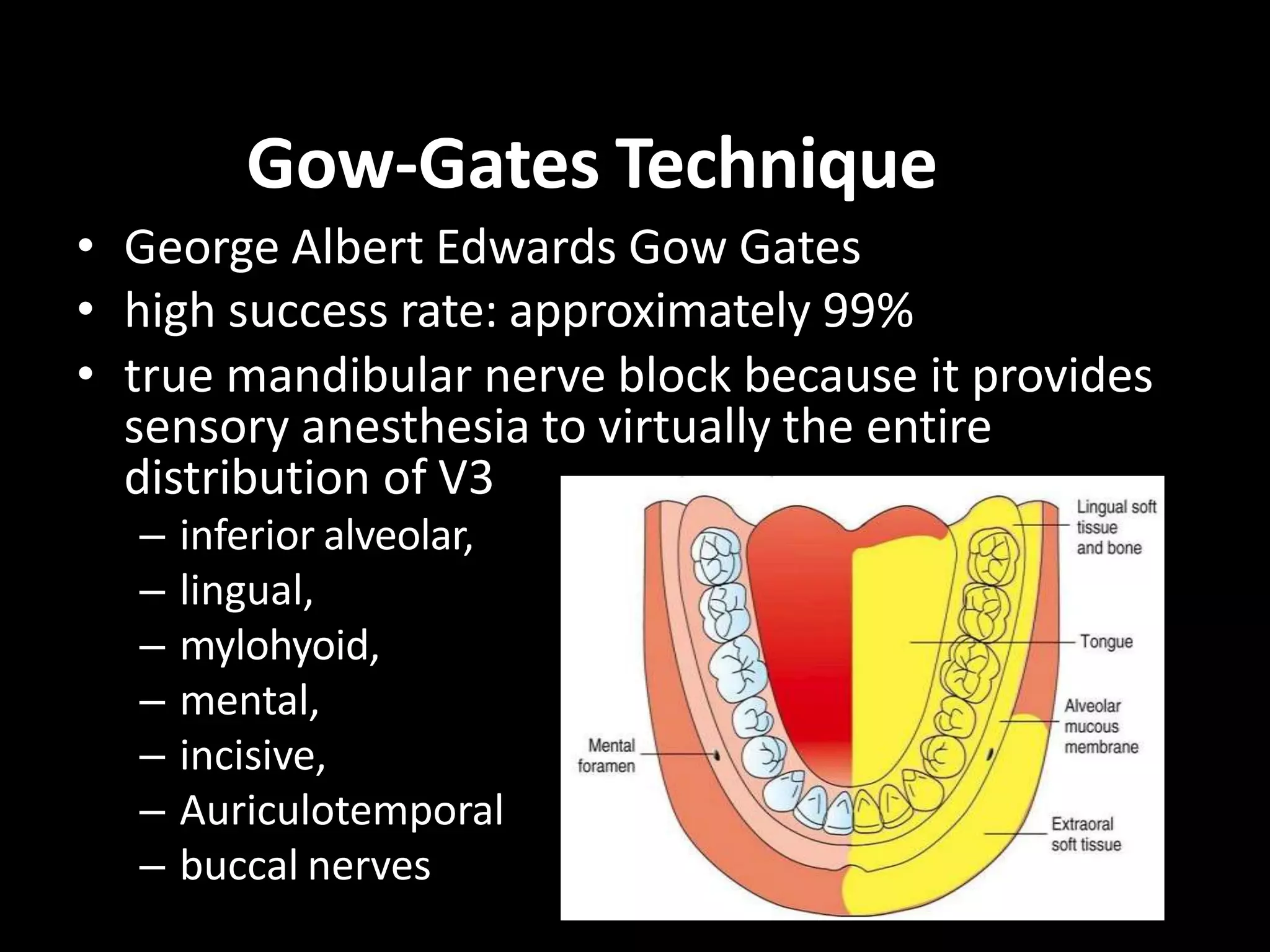 Mandibular anesthesia | PPTX