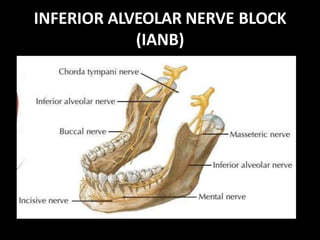 Mandibular anesthesia | PPTX