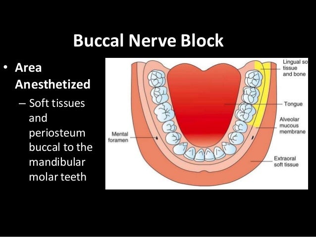 Mandibular anesthesia