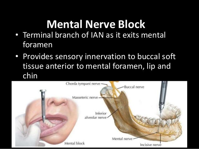 Mandibular anesthesia
