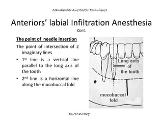 Mandibular anesthetic techniques | PDF
