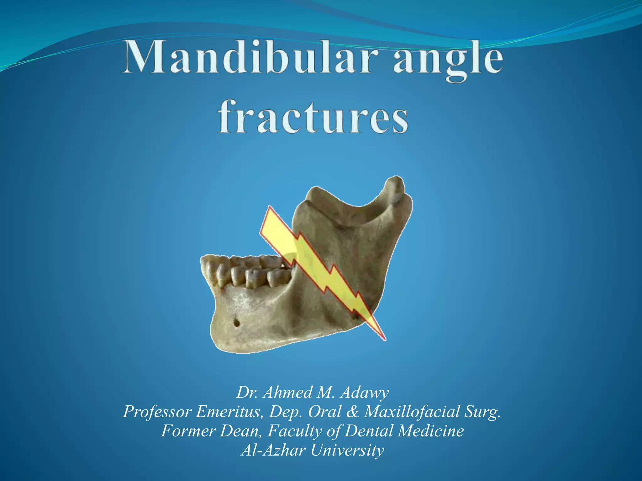 Mandibular Angle Fractures | PPTX