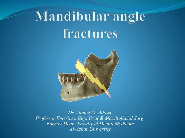 Mandibular Angle Fractures | PPTX | First Aid | Injuries