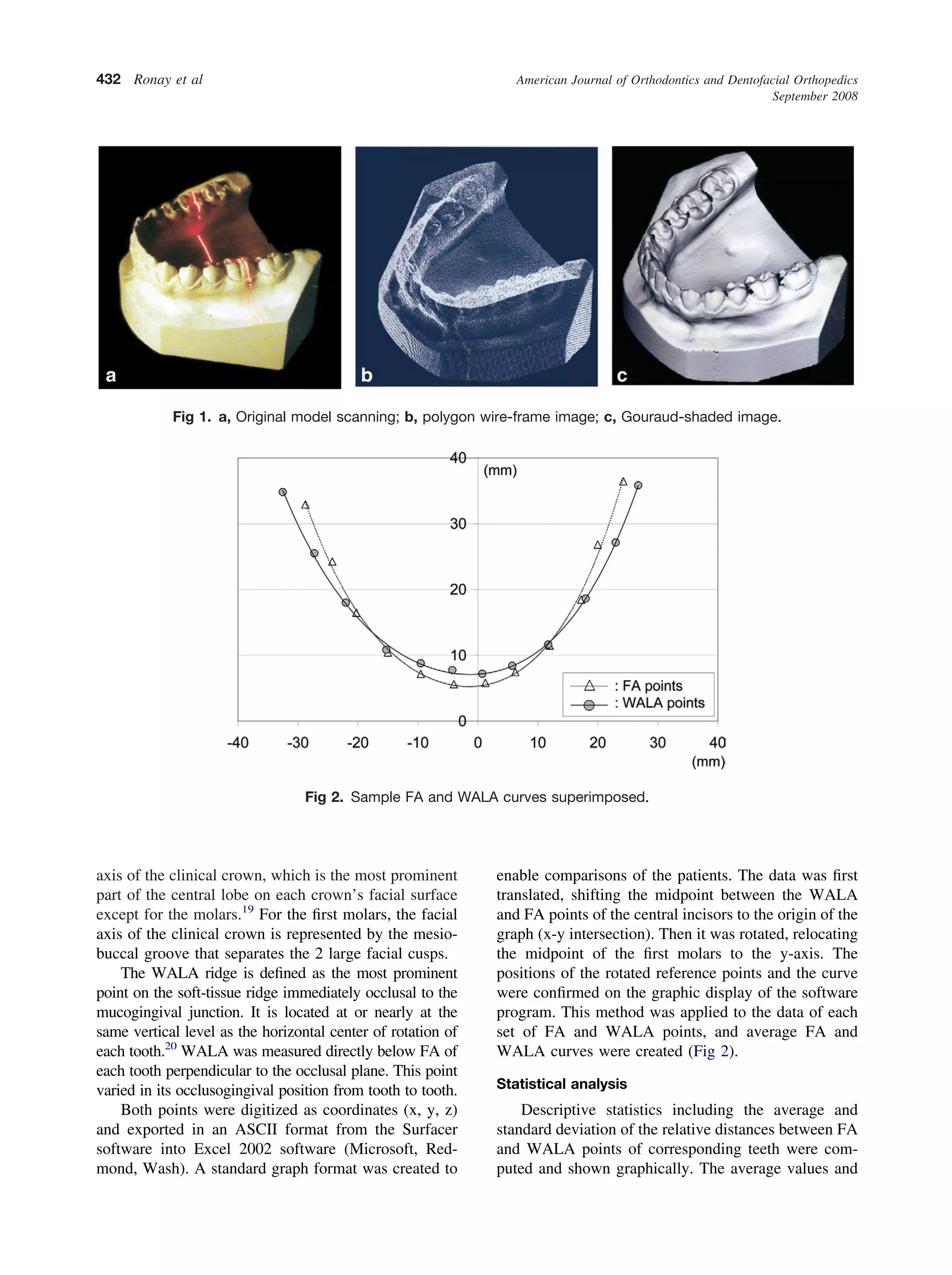 Mandibular arch form the relationship between dental and basal anatomy ...