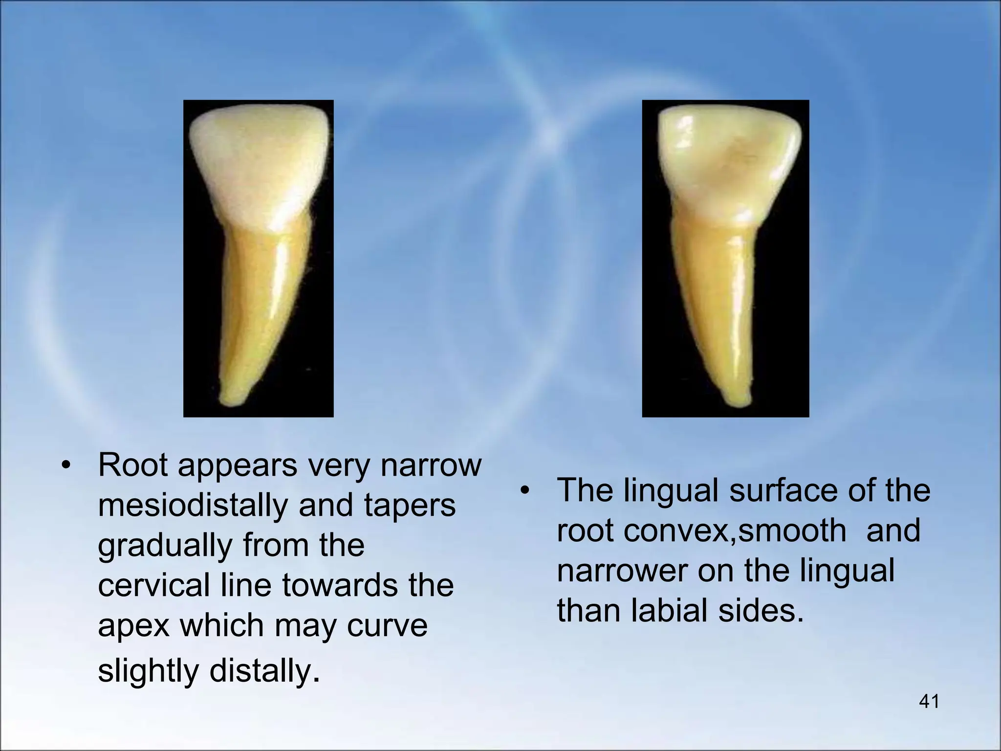 MANDIBULAR CENTRAL AND LATERAL INCISOR.ppt