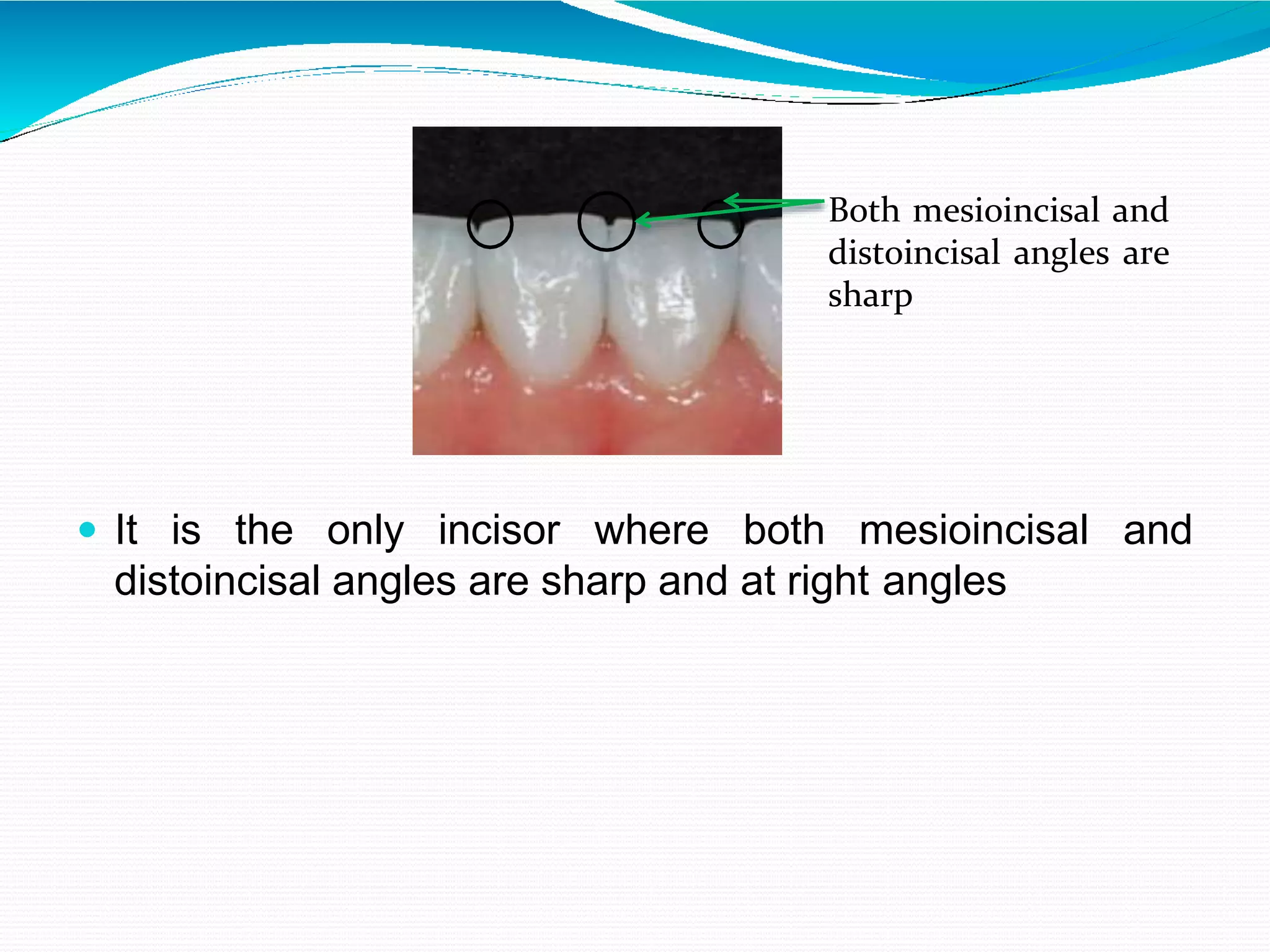 Mandibular central incisor | PPTX
