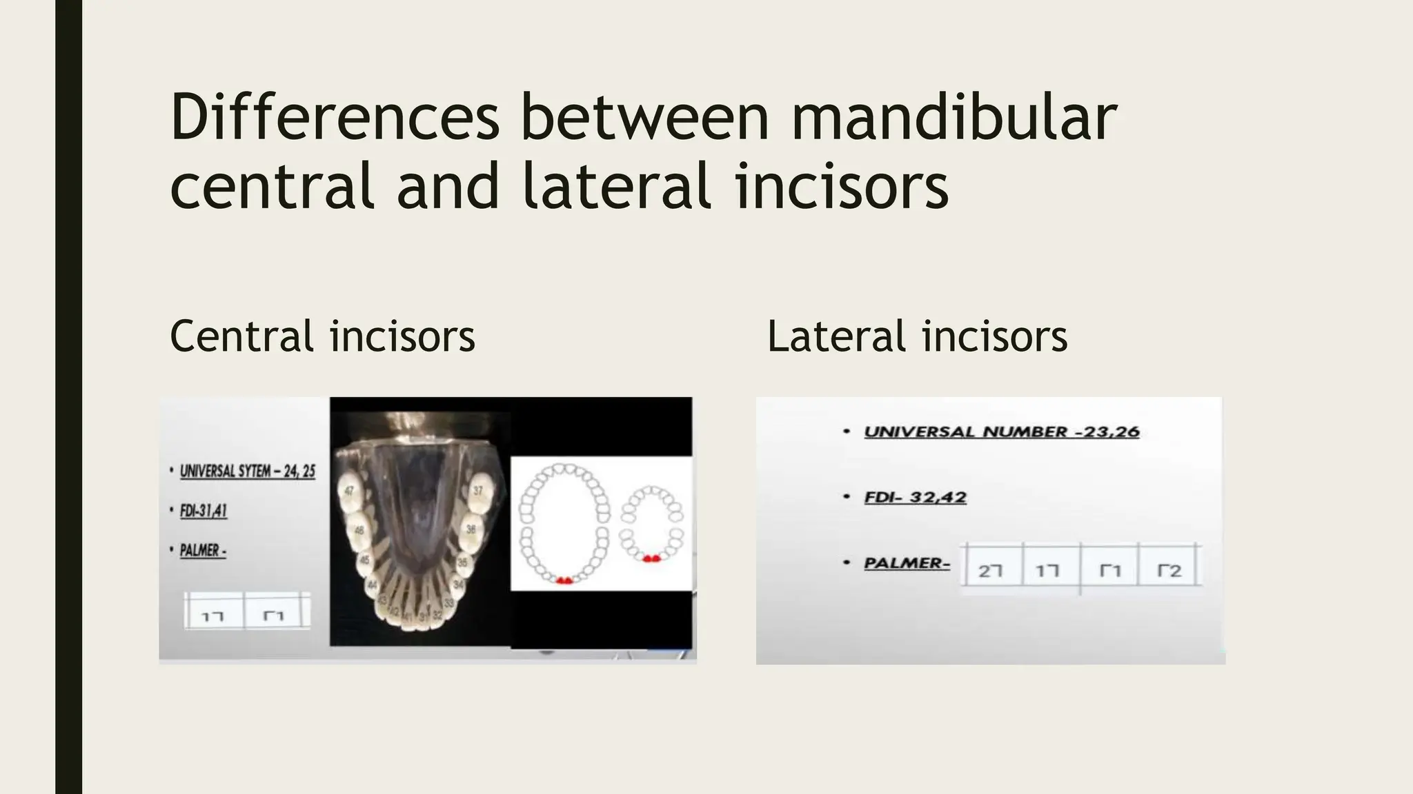 mandibular central versus lateral tooth morphologypptx | PPT