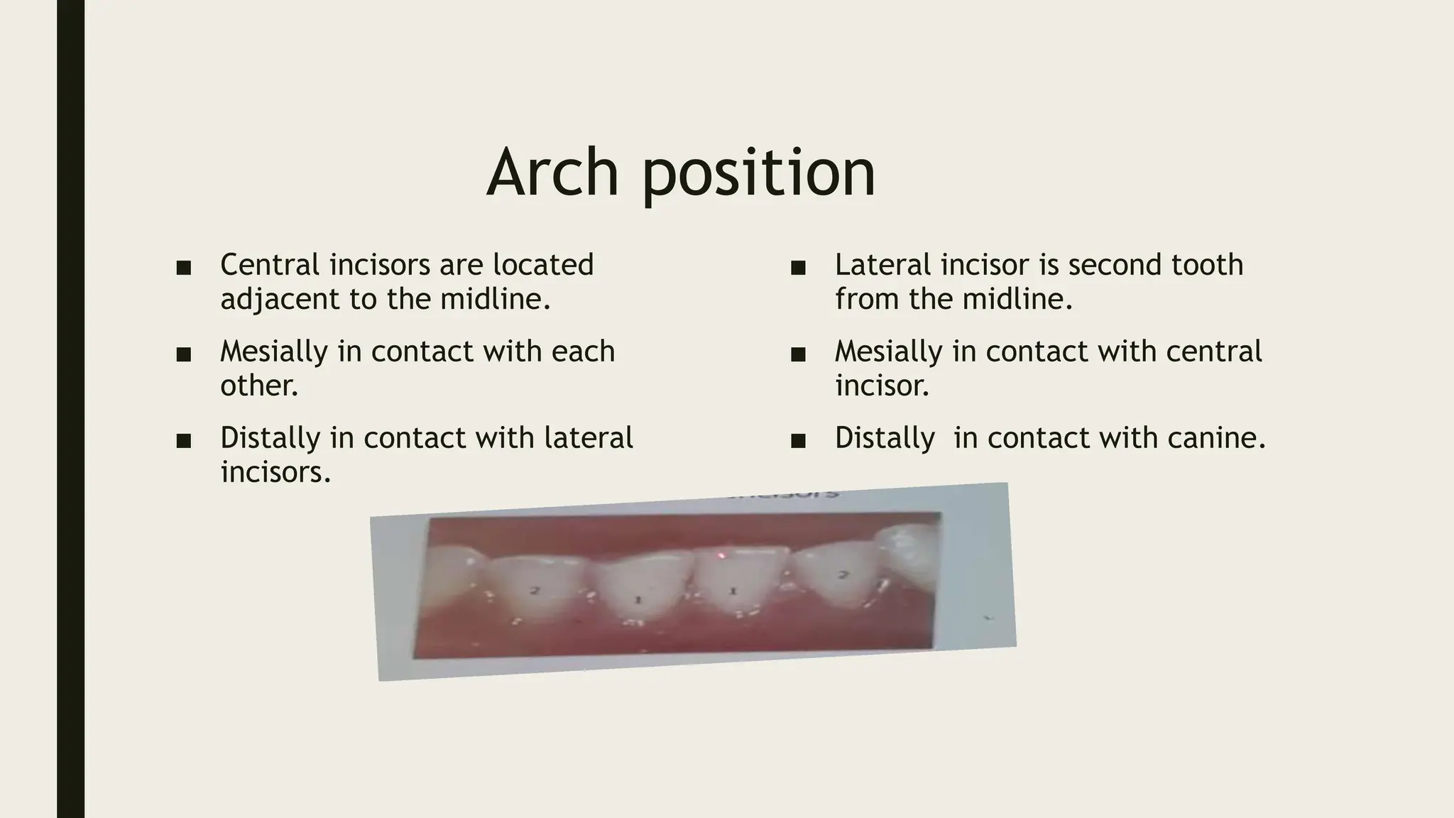 mandibular central versus lateral tooth morphologypptx | PPT