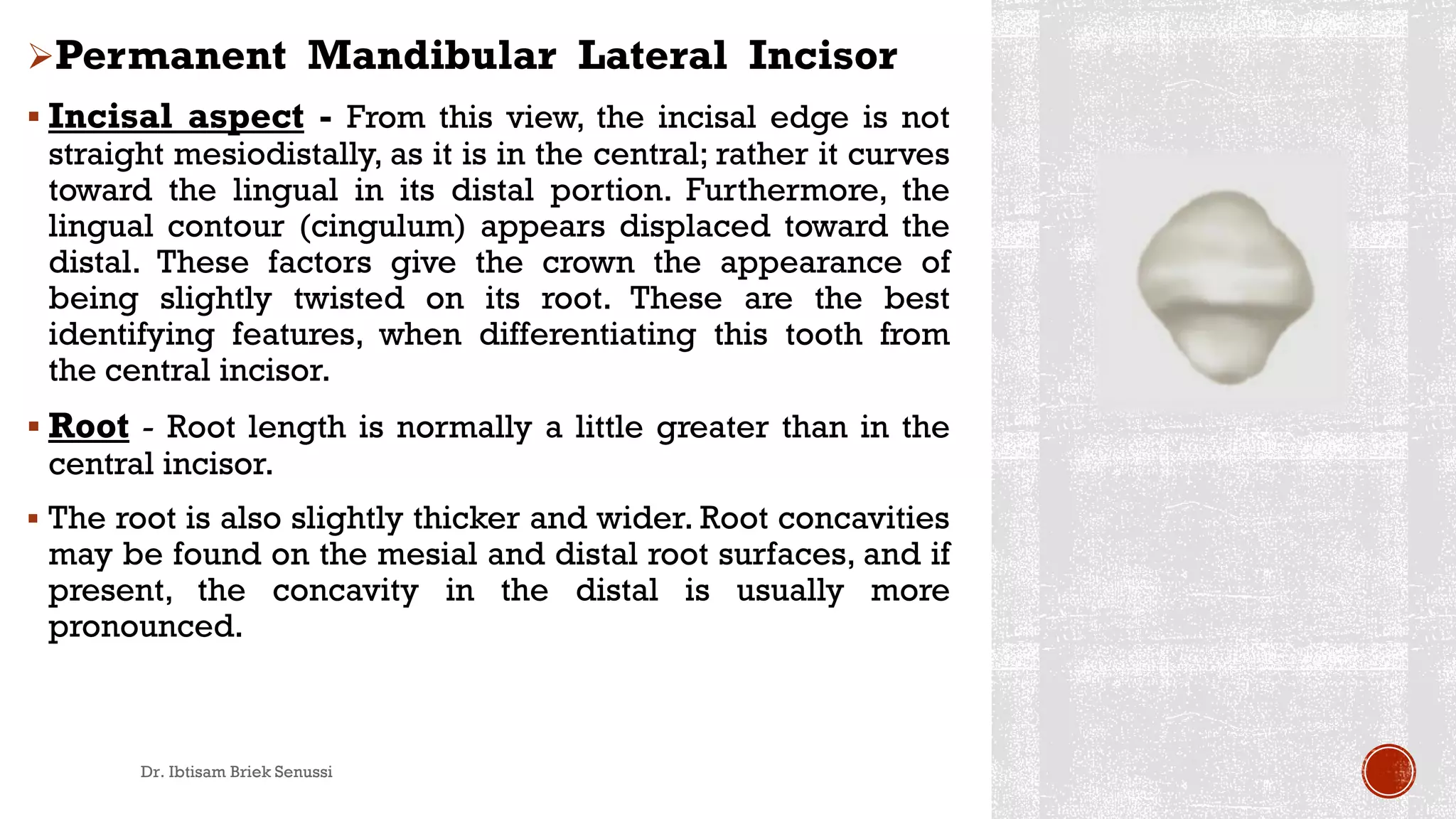 The mandibular incisors | PDF