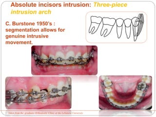 Mandibular curve of spee | PPTX