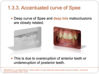 Mandibular curve of spee | PPTX