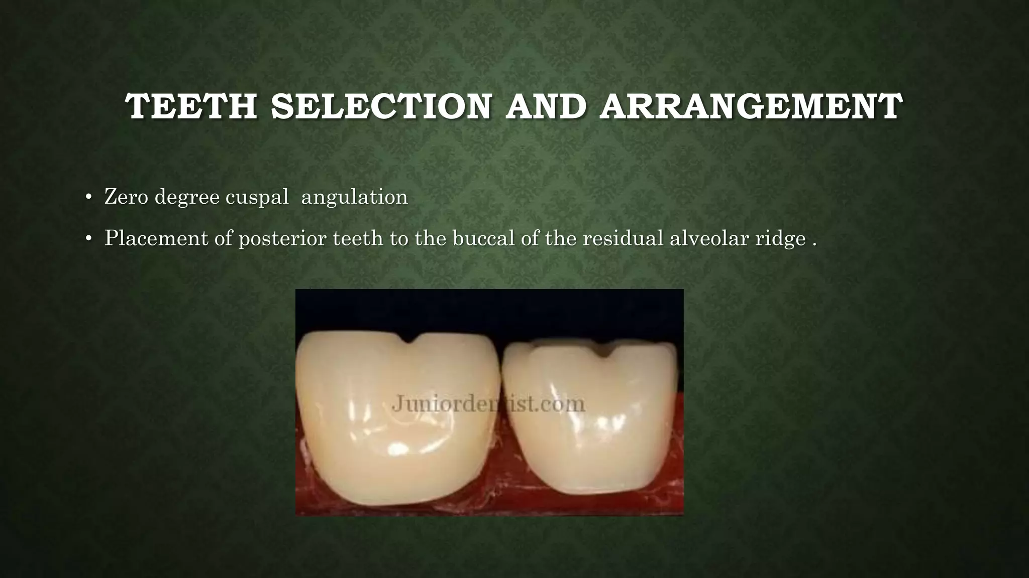 MANDIBULAR_DEFECTS( SEMI 4).pptx
