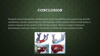 MANDIBULAR_DEFECTS( SEMI 4).pptx