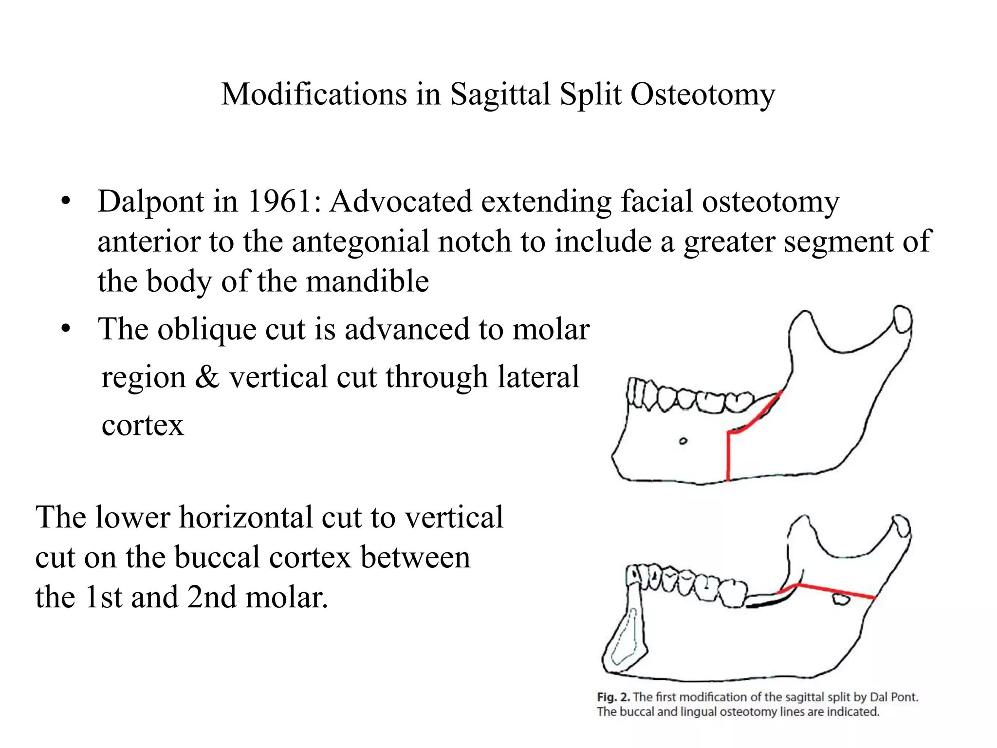 Mandibular Deformities & their Management | PPTX
