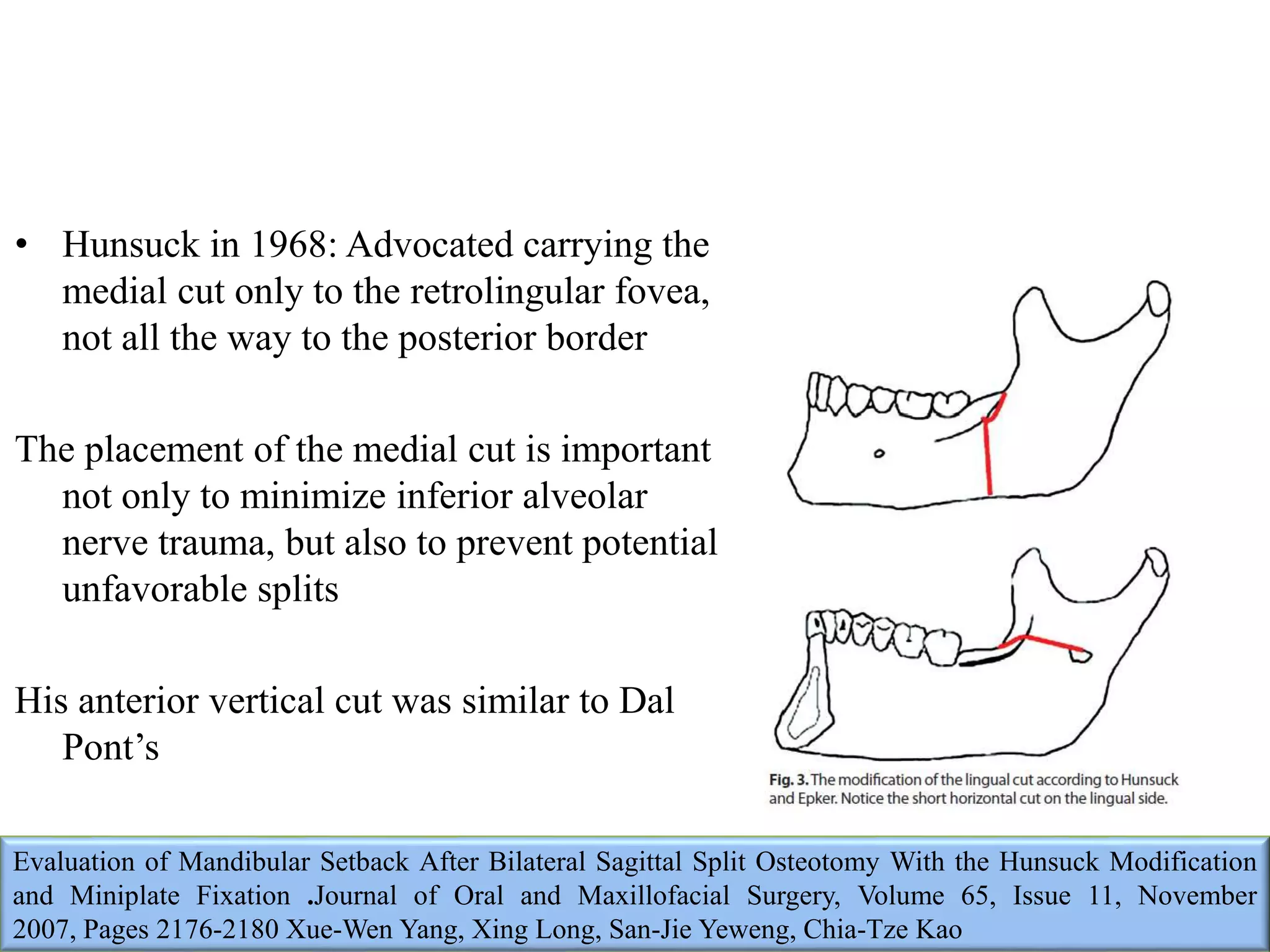 Mandibular Deformities & their Management | PPTX