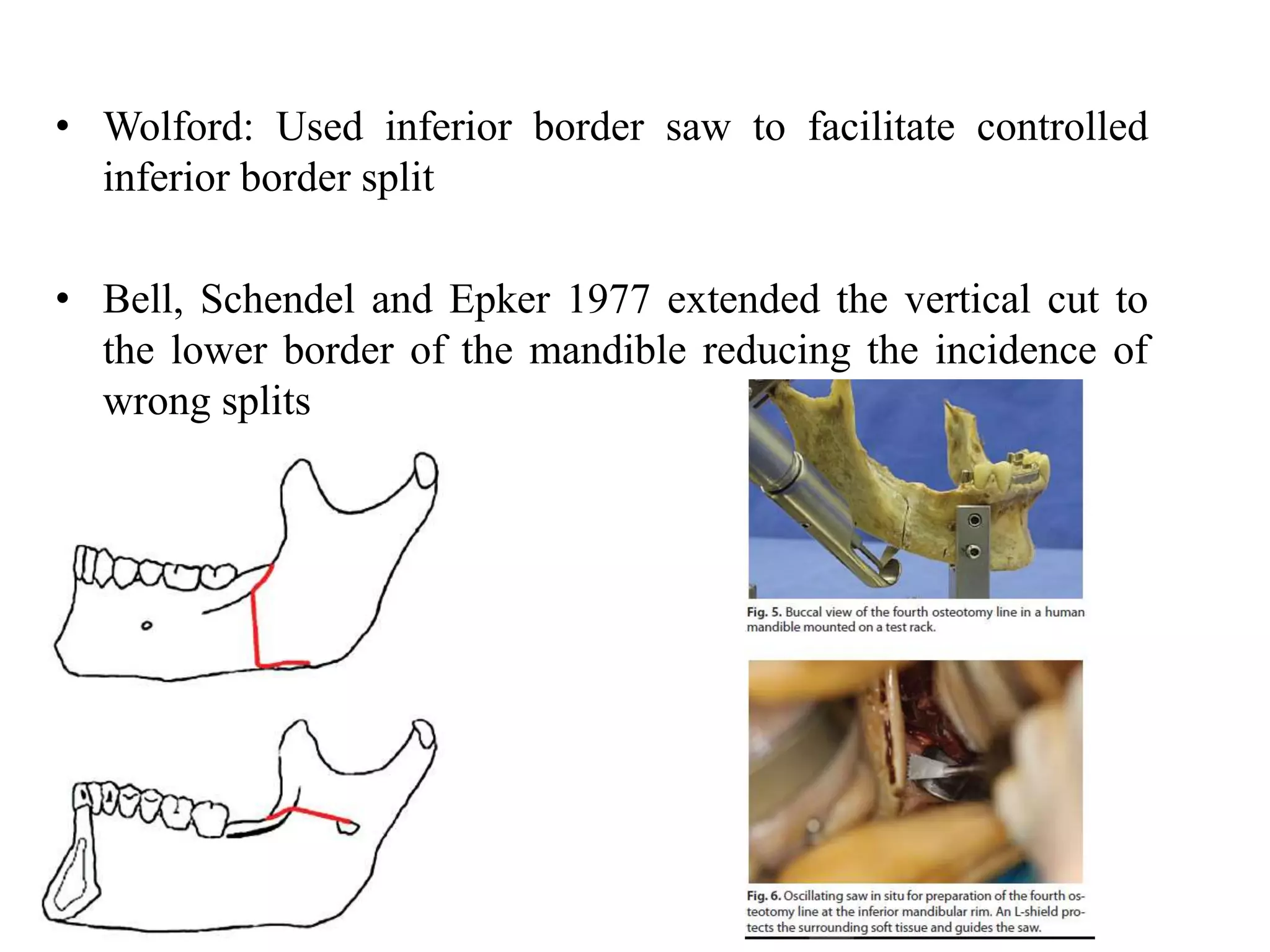 Mandibular Deformities & their Management | PPTX