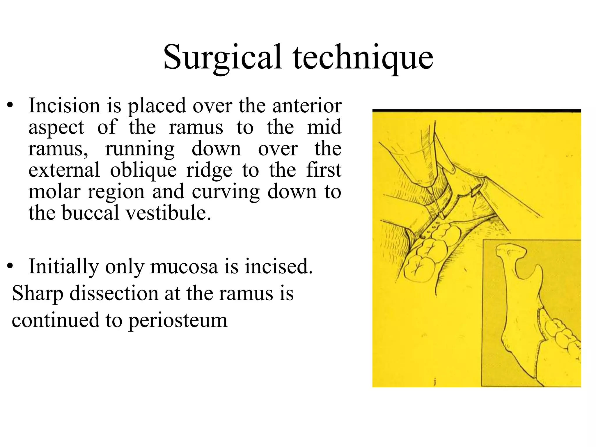 Mandibular Deformities & their Management | PPTX