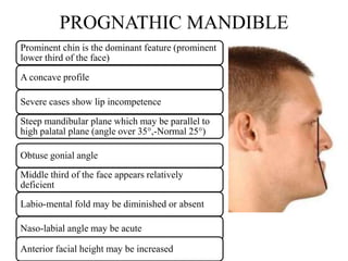Mandibular Deformities & their Management | PPTX