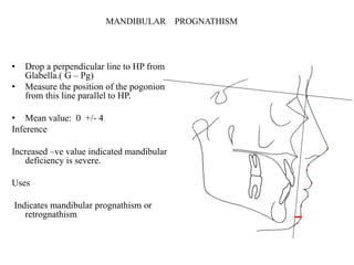 Mandibular Deformities & their Management | PPTX