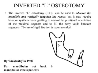 Mandibular Deformities & their Management | PPTX