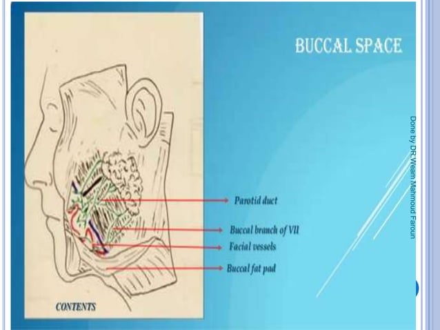 Mandibular facsial spaces | PPTX