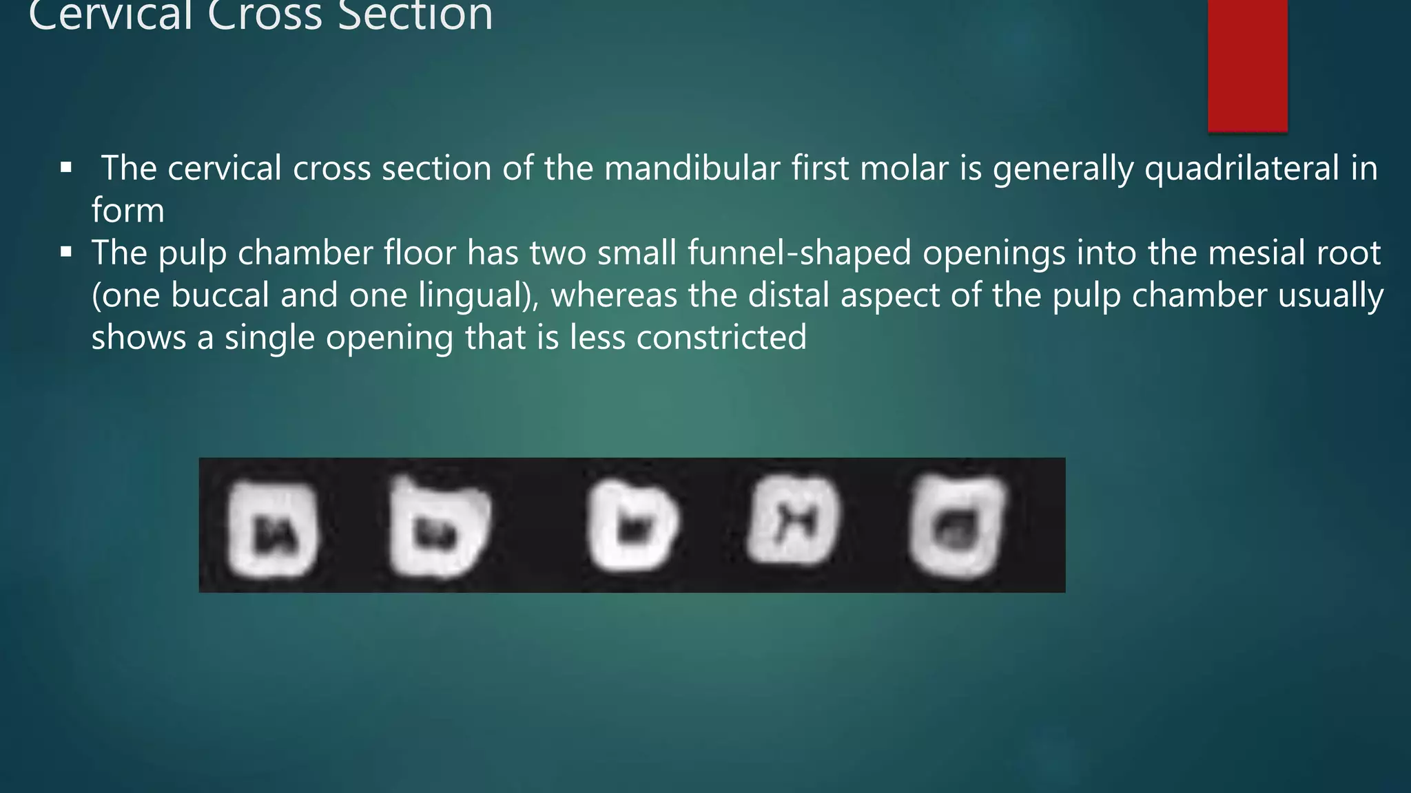 Mandibular first molar pulp canal morphology | PPTX