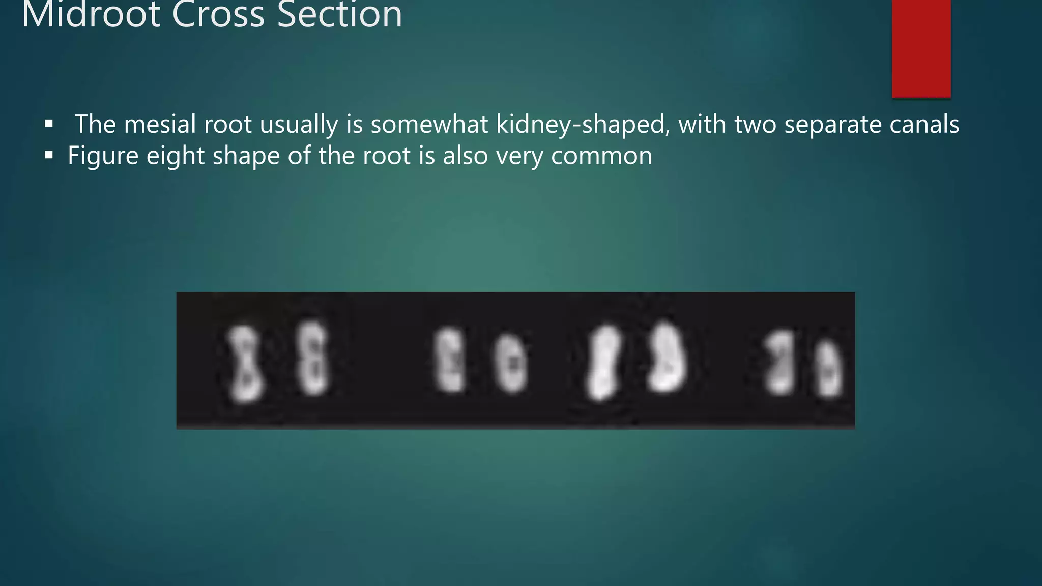 Mandibular first molar pulp canal morphology | PPTX