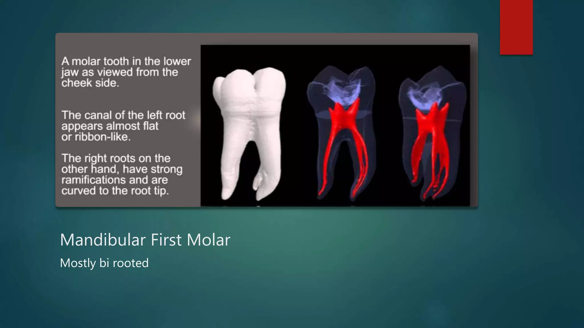 Mandibular first molar pulp canal morphology | PPTX