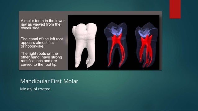 Mandibular first molar pulp canal morphology