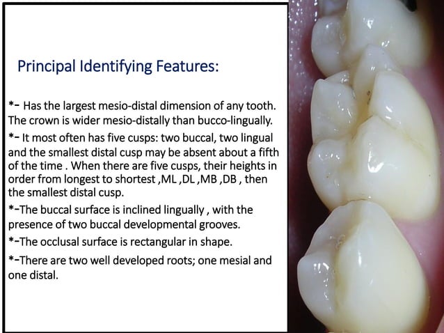MANDIBULAR first molars. (1) (1) (1).pdf