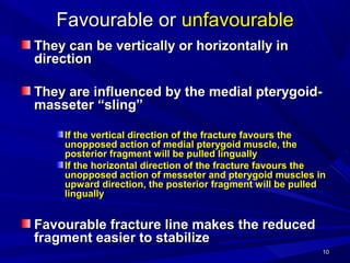 Mandibular fractres | PPT