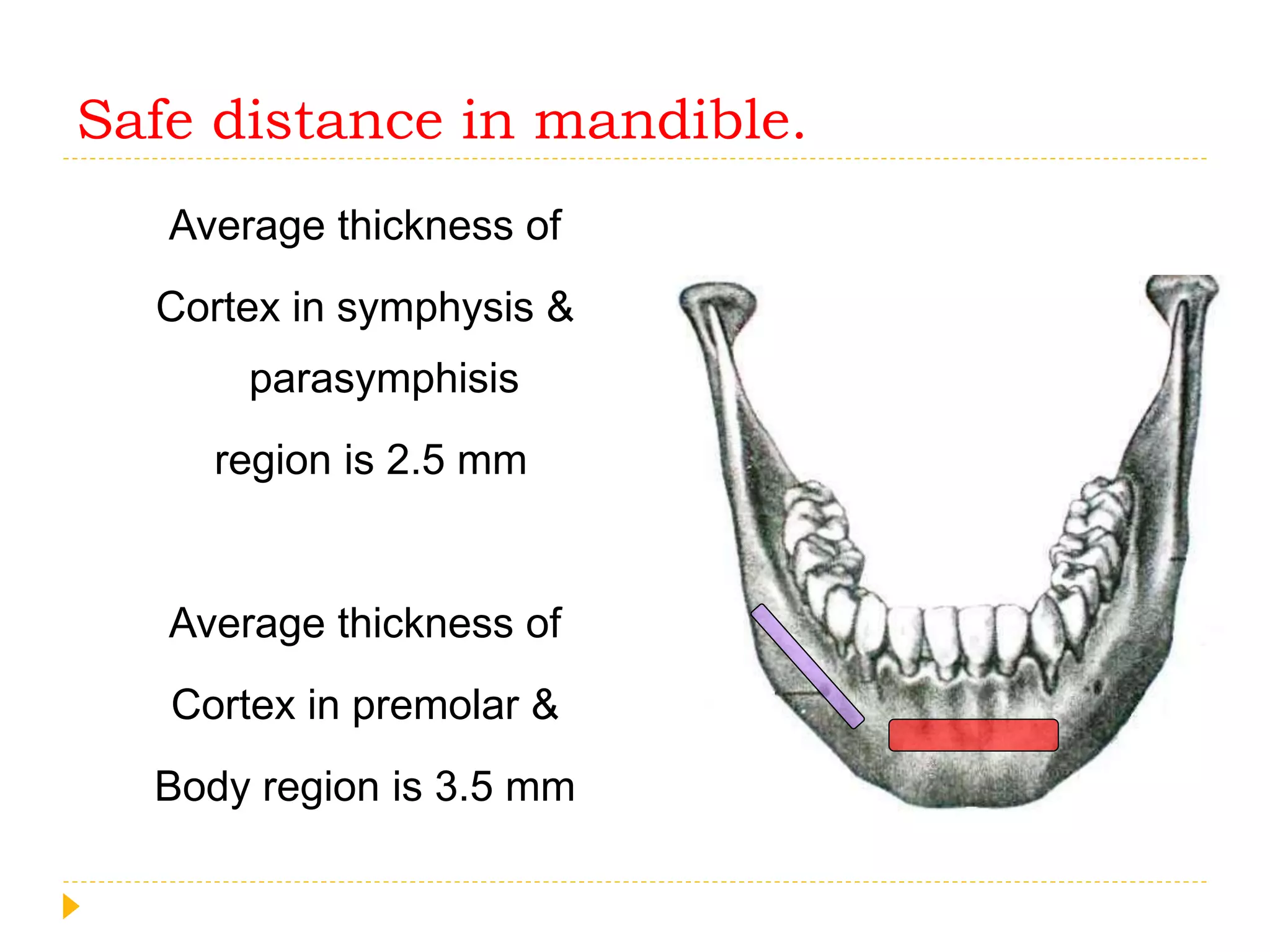Mandibular fracture | PPTX