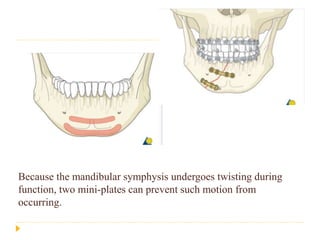 Mandibular Symphysis